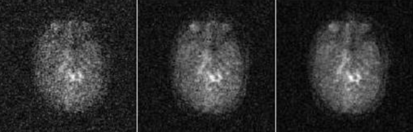 Past Study: Development of non-Fourier MR Spectroscopy Protocols for ...